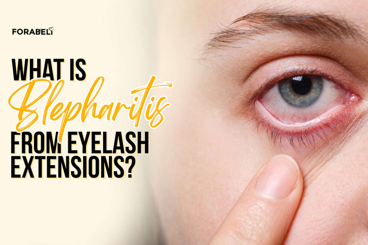 What is Blepharitis from Eyelash Extensions? – Forabeli