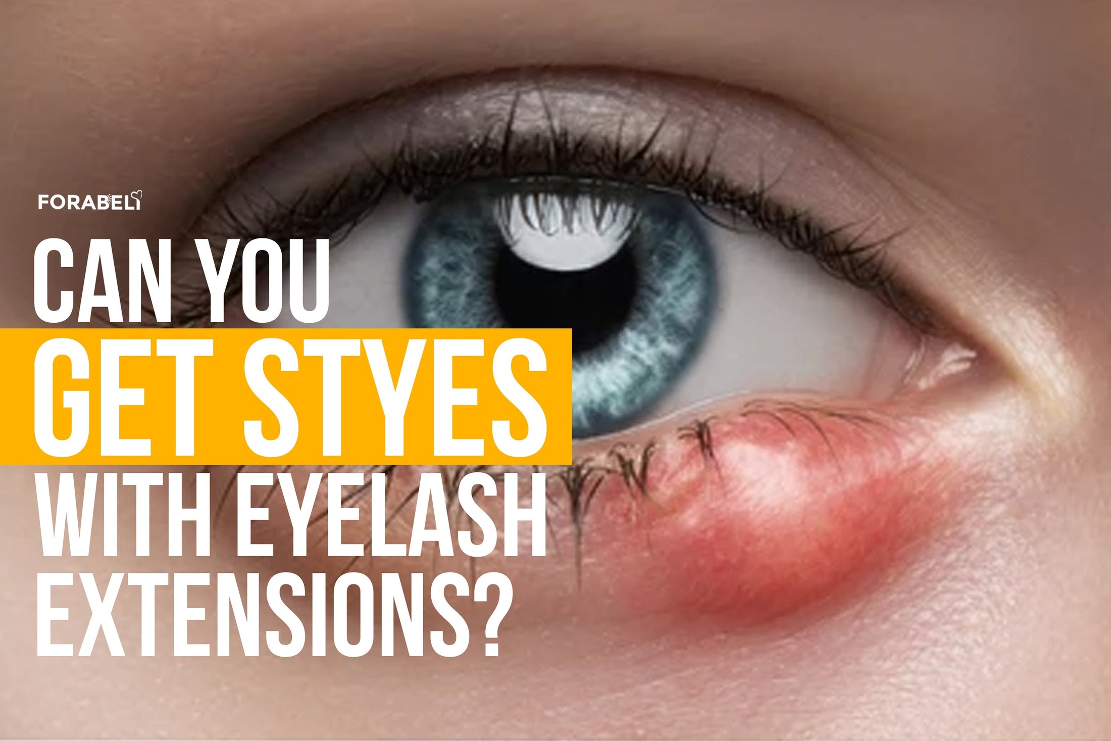 Can Eyelash Extensions Cause Styes? How to Treat & Prevent – Forabeli